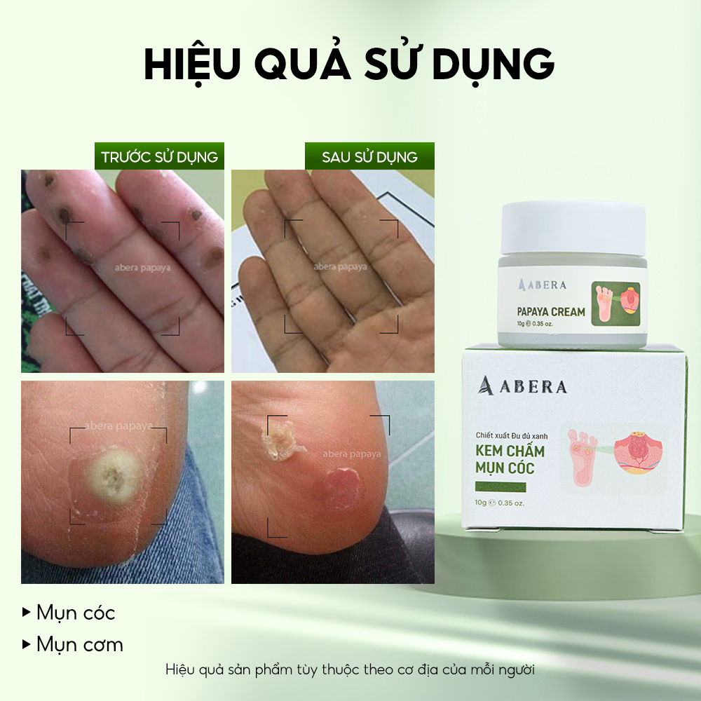 Abera Papaya Có Hiệu Quả Thực Sự Không ? Mua Ở Đâu ? Giá Bao Nhiêu Tiền ...
